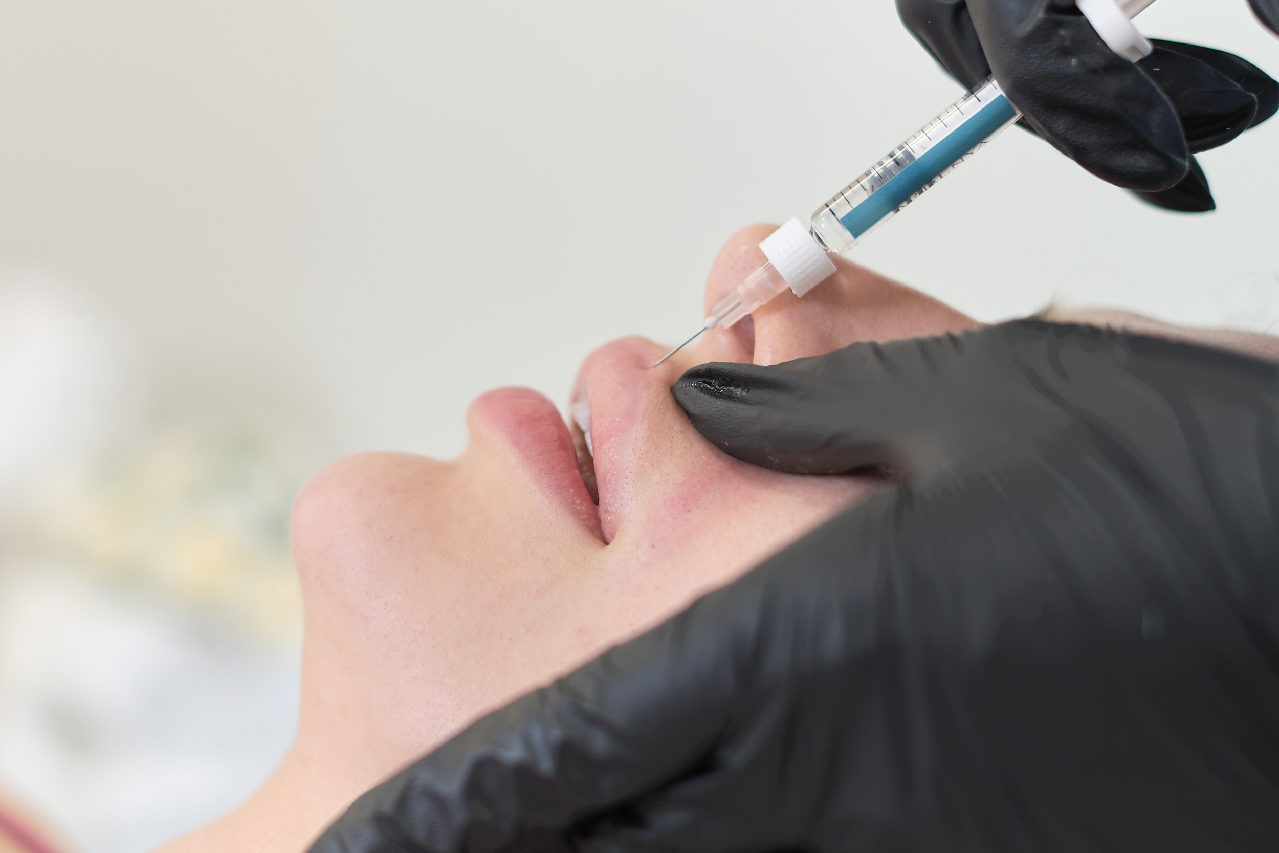 A Tampa Med Spa’s Complete Guide To Dermal Fillers - Defining Beauty ... A Tampa Med Spa’s Complete Guide To Dermal Fillers - Defining Beauty ...
